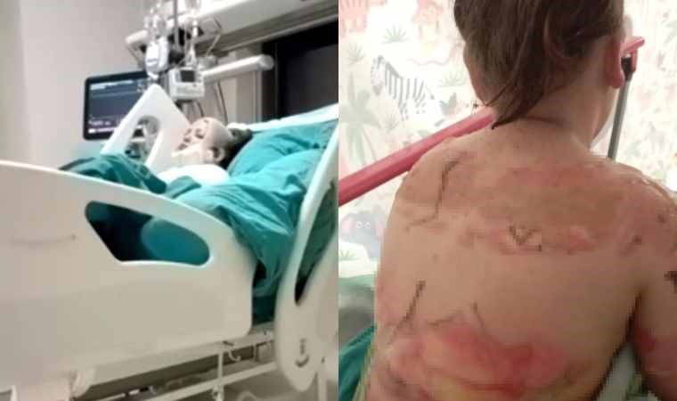 Sobada ısınmak isterken alev aldı! 10 yaşındaki çocuk okulda dehşeti ...